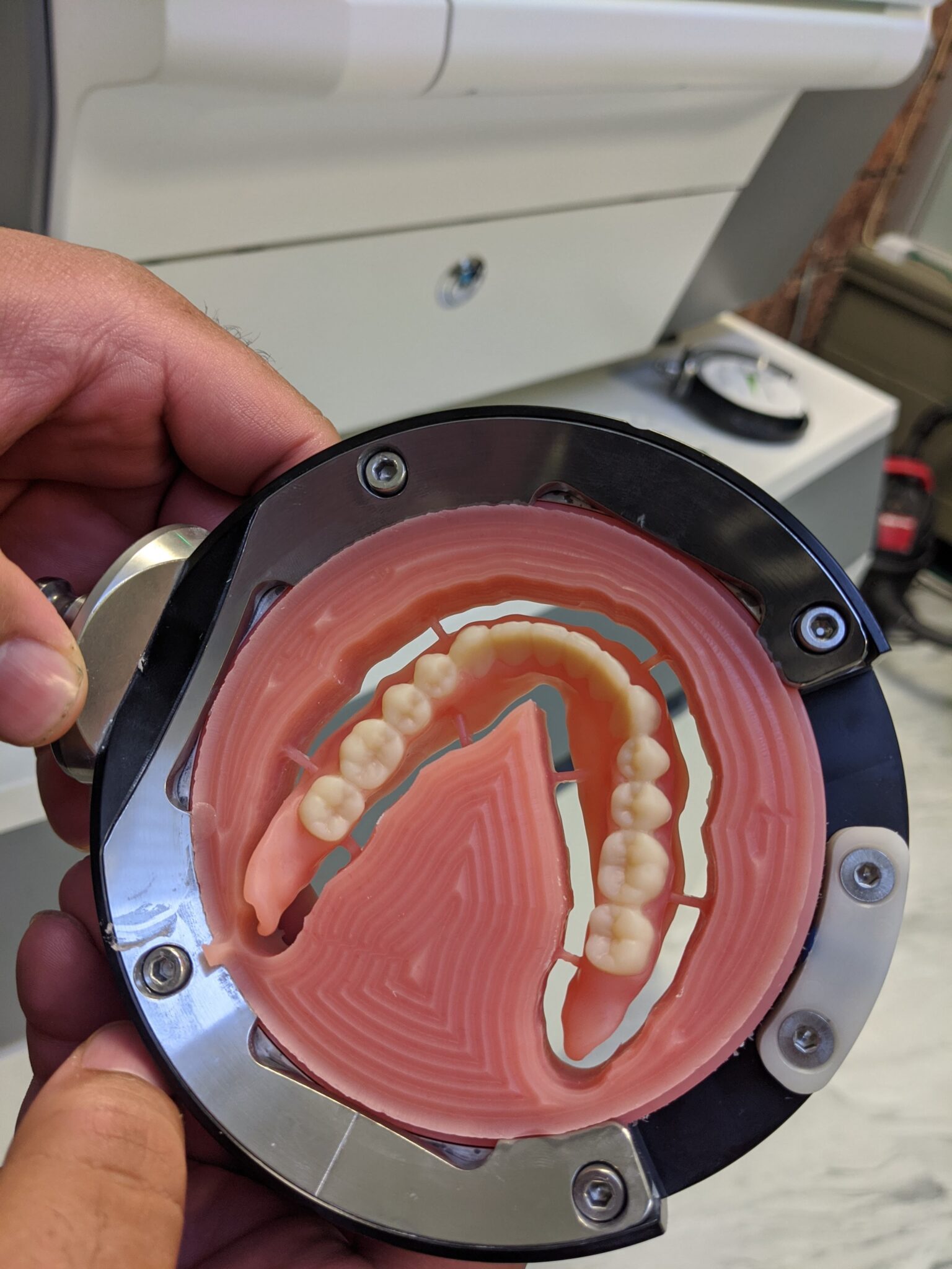 Digital Dentures - Charing Cross Implant Denture Clinic