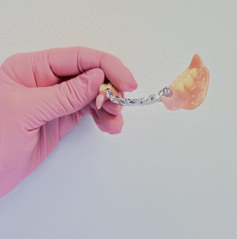 Partial Dentures - Charing Cross Implant Denture Clinic